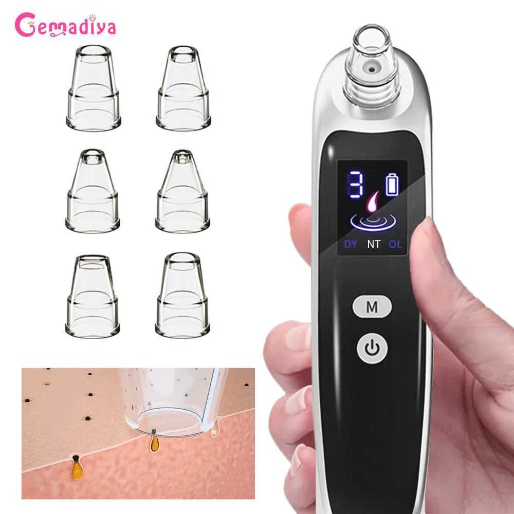 Electric Blackhead Remover - Pore Vacuum Cleaner for Acne & Pimple ...