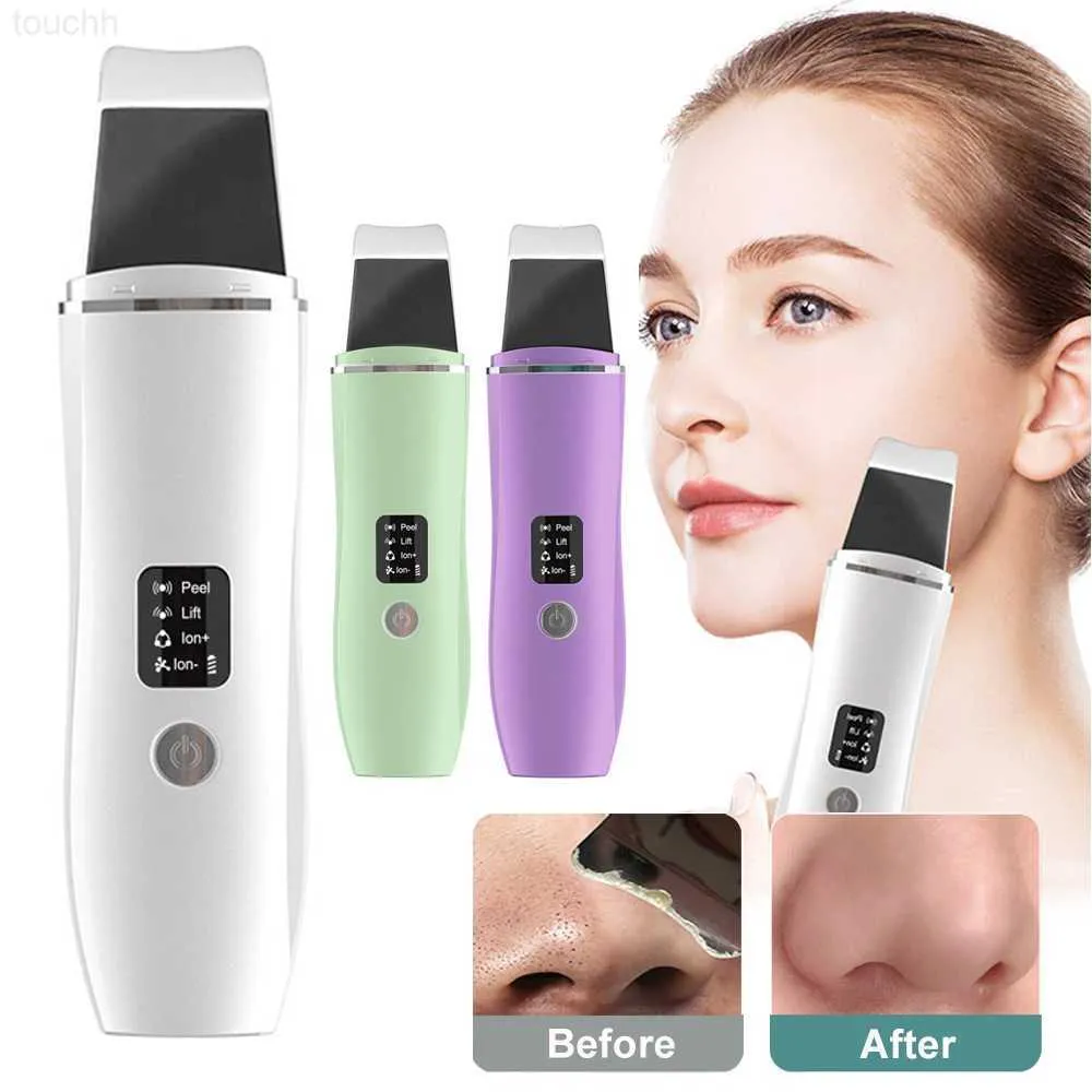 Electric Face Scrubbers Ultrasonic Skin Scrubber Peeling Blackhead ...