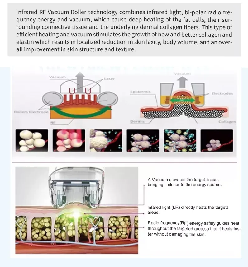 Multi Functional Vacuum Body Sculpting Machine With RF Vacuum Roller ...