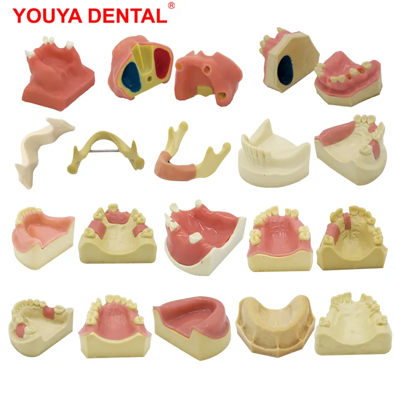 Other Oral Hygiene Youya Dental Model Teeth Implant Practice Model ...