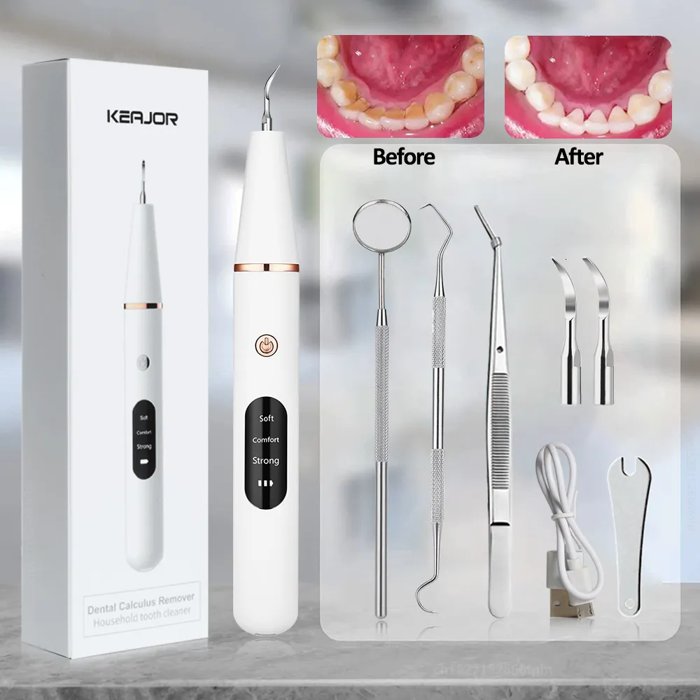 DHgate.com:Ultrasonic Dental Calculus Remover, Teeth Plaque Tartar ...