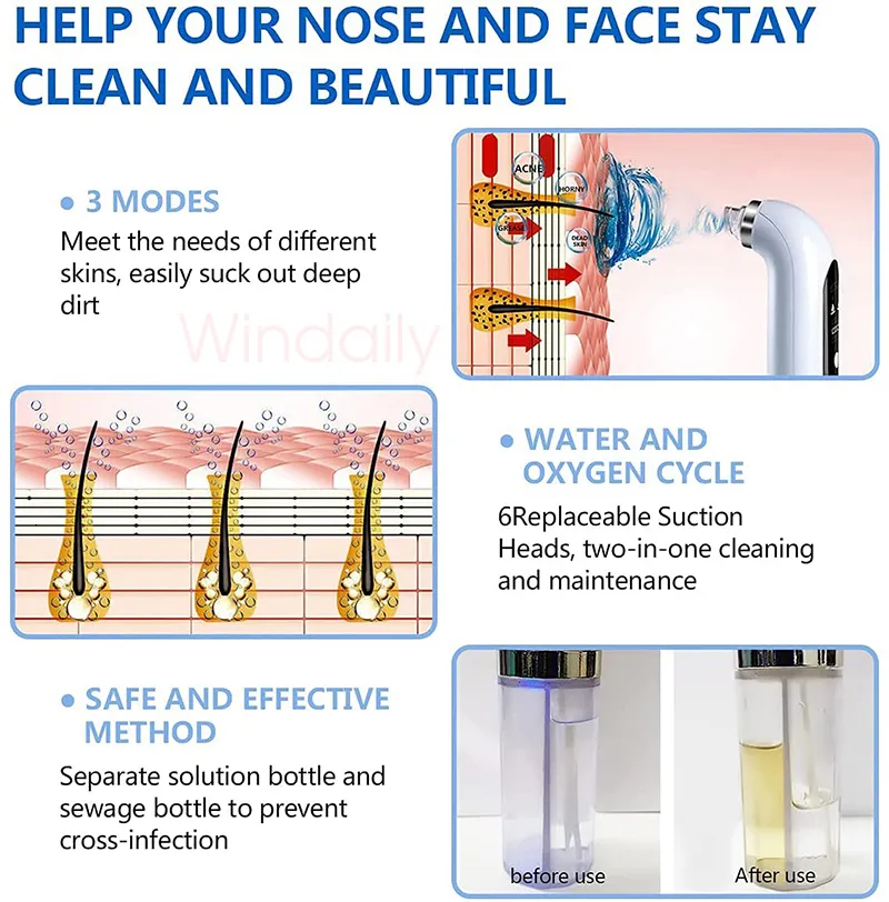 Pore Vacuum Blackhead Remover - Electric Facial Cleanser, Micro Bubble ...
