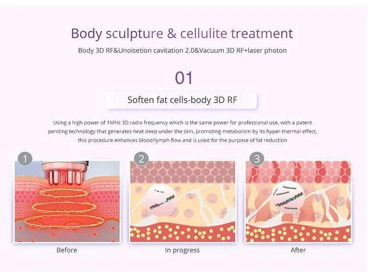 8-in-1 40K Unoisetion Cavitation Weight Loss Machine with Radio ...