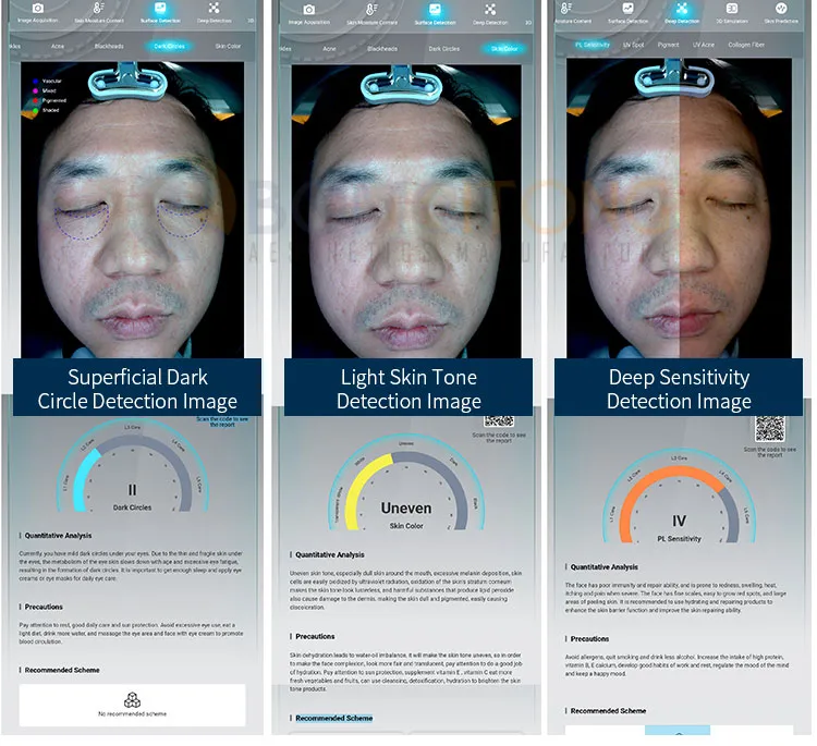 Customizable 3D Skin Analysis Machine with FDA Approval, 1-Year ...