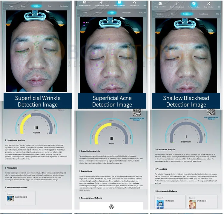 Customizable 3D Skin Analysis Machine with FDA Approval, 1-Year ...