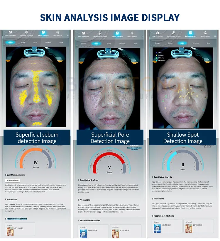 Customizable 3D Skin Analysis Machine with FDA Approval, 1-Year ...