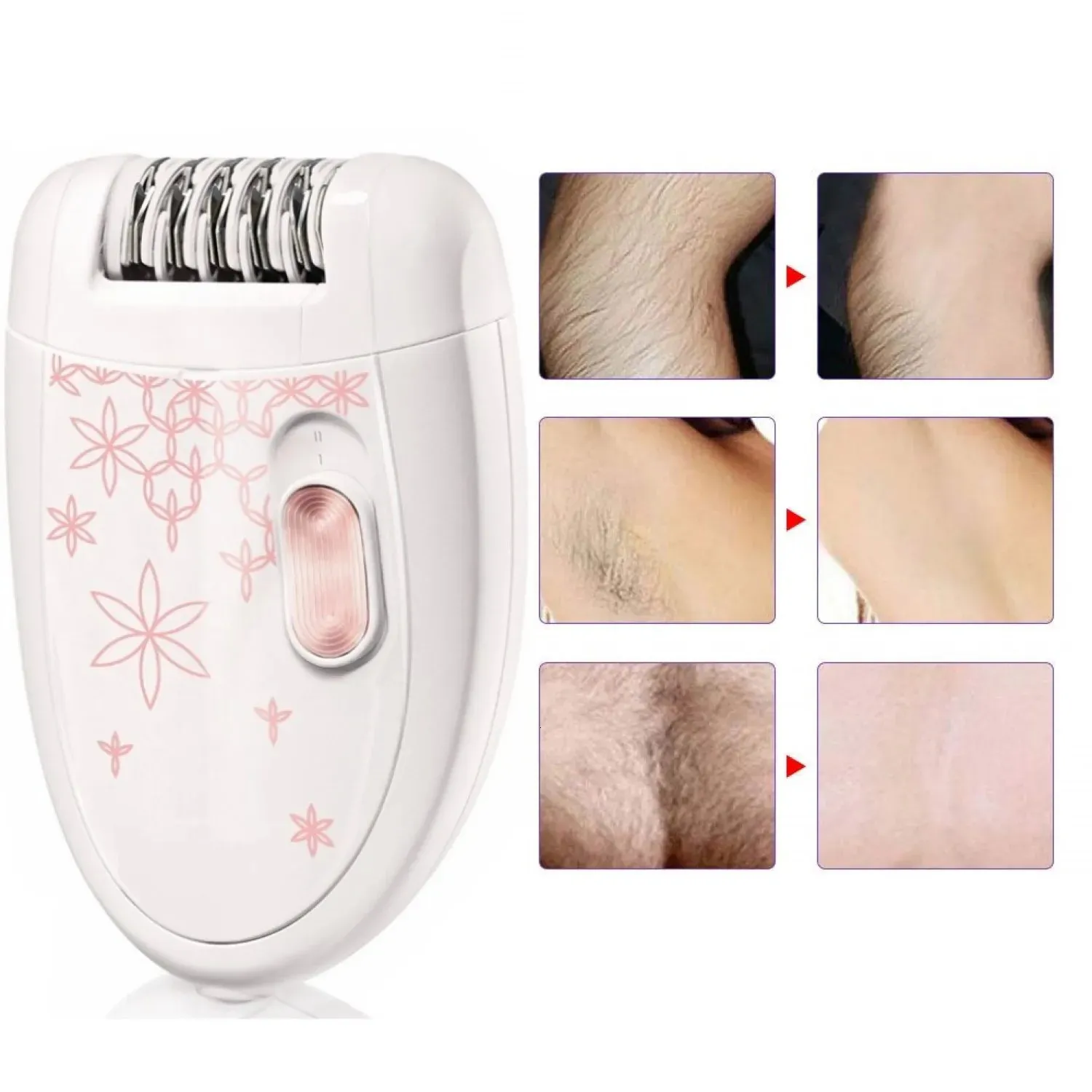100-240V Corded Women's Epilator: Electric Hair Removal for Body ...