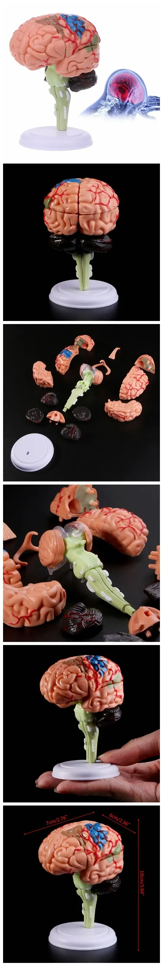4D Human Brain Model - Disassembled Anatomy Teaching Tool, Detailed ...
