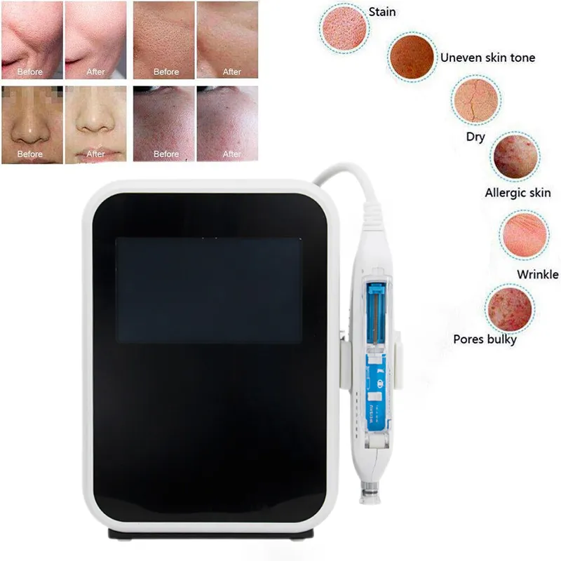 Portable Skin Glow Injector Meso Gun Anti Wrinkle Lifting Water Spray ...