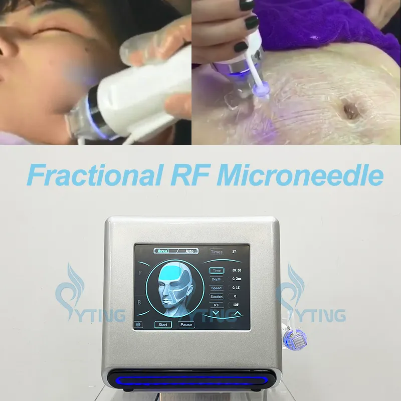 Fractional RF Radiofrequency Micro Needling Machine For Acne Scars ...