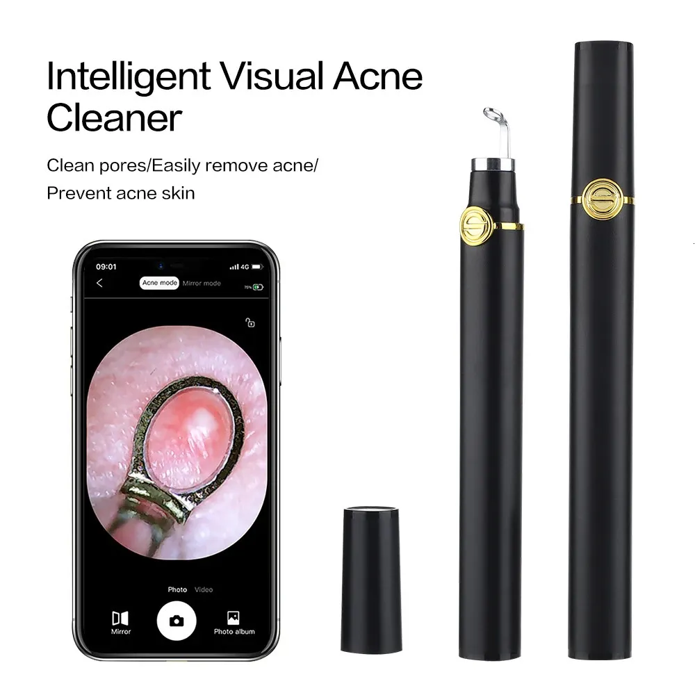 DHgate.com:Cleaning Tools Accessories Visual Blackhead Remover Pore ...