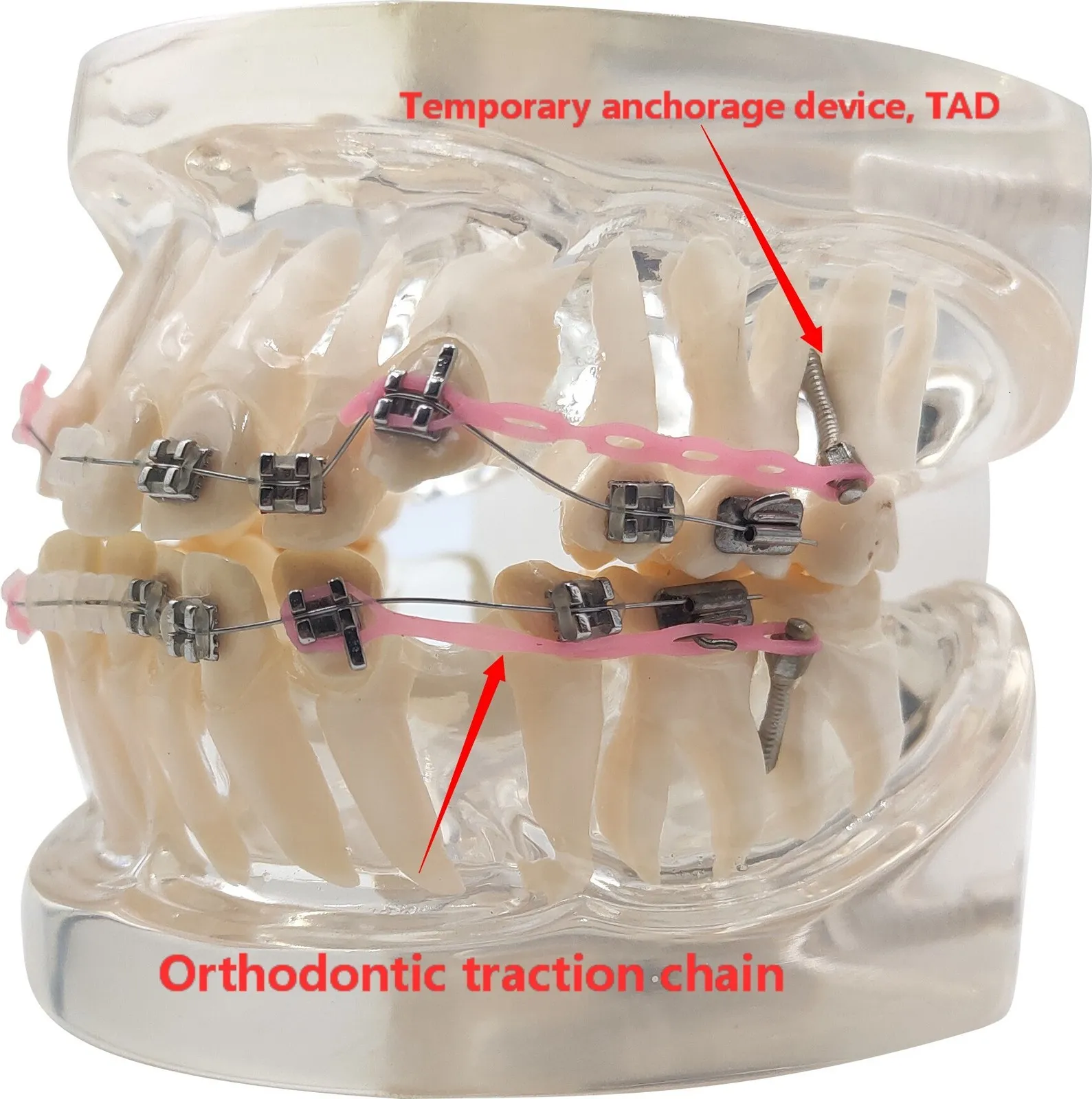 DHgate.com:Orthodontic Tooth Model for Studying and Teaching - 1010cm ...