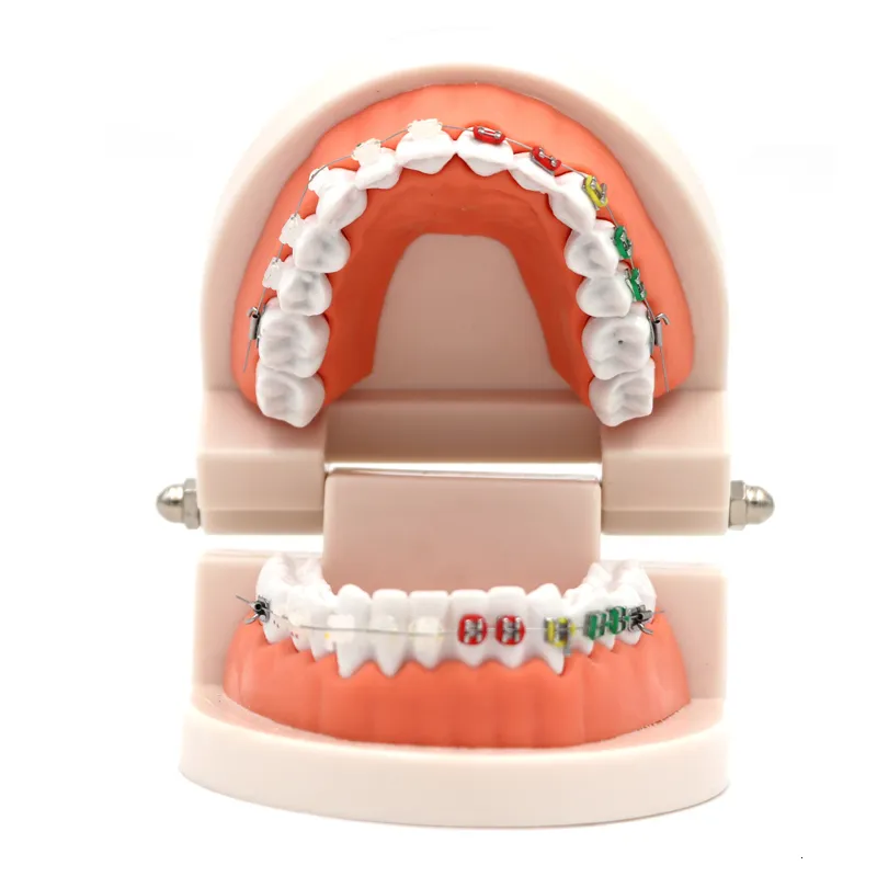 DHgate.com:Orthodontic Treatment Model Typodont with Metal Ceramic ...