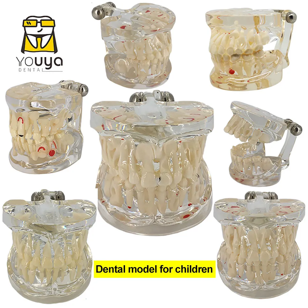 Kids' Dental Model: Deciduous & Permanent Teeth Study Aid - Pediatric ...