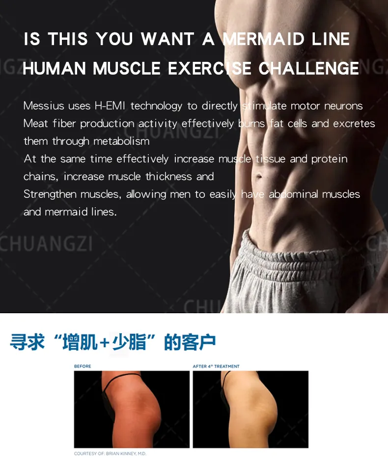 1. It can set different muscle training modes.