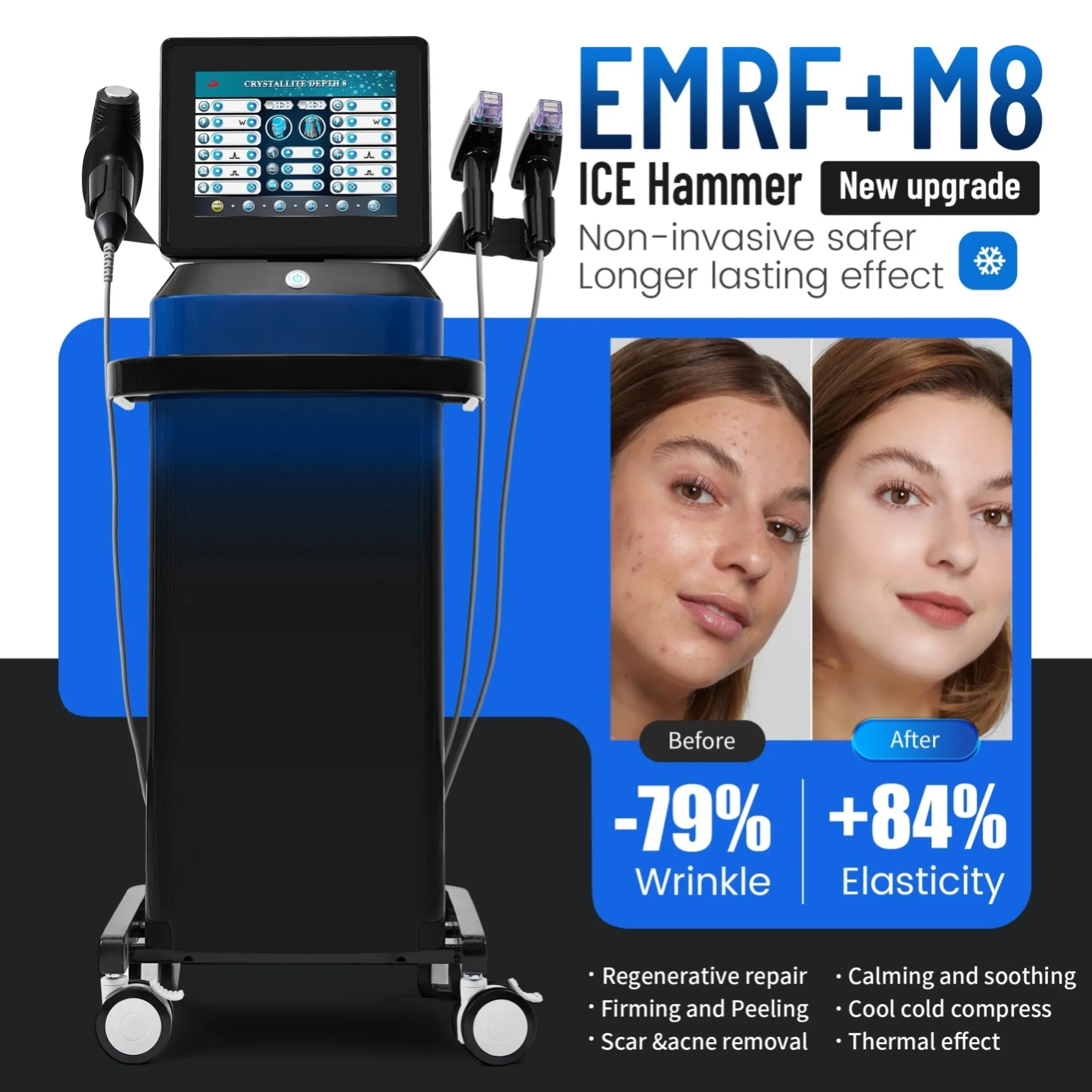 RF Microneedling Machine: Professional Radio Frequency Skin Tightening ...