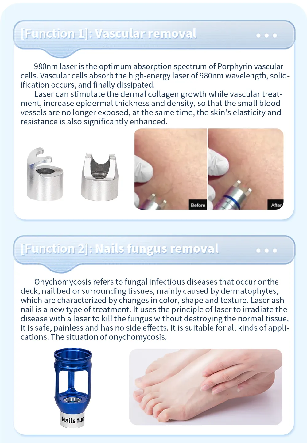 980nm Laser Multifunction Equipment for Vascular Removal and Nail ...