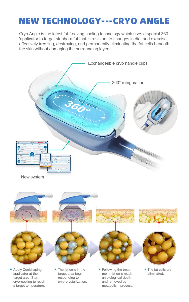 New Cryo 360 Body Slimming Machine For Effective Fat Dissolving, Skin ...