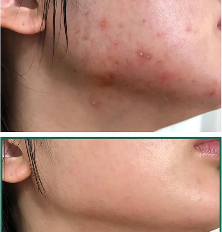 Keratin Care Soothing Repair Serum for Combination Skin Liquid Formula ...