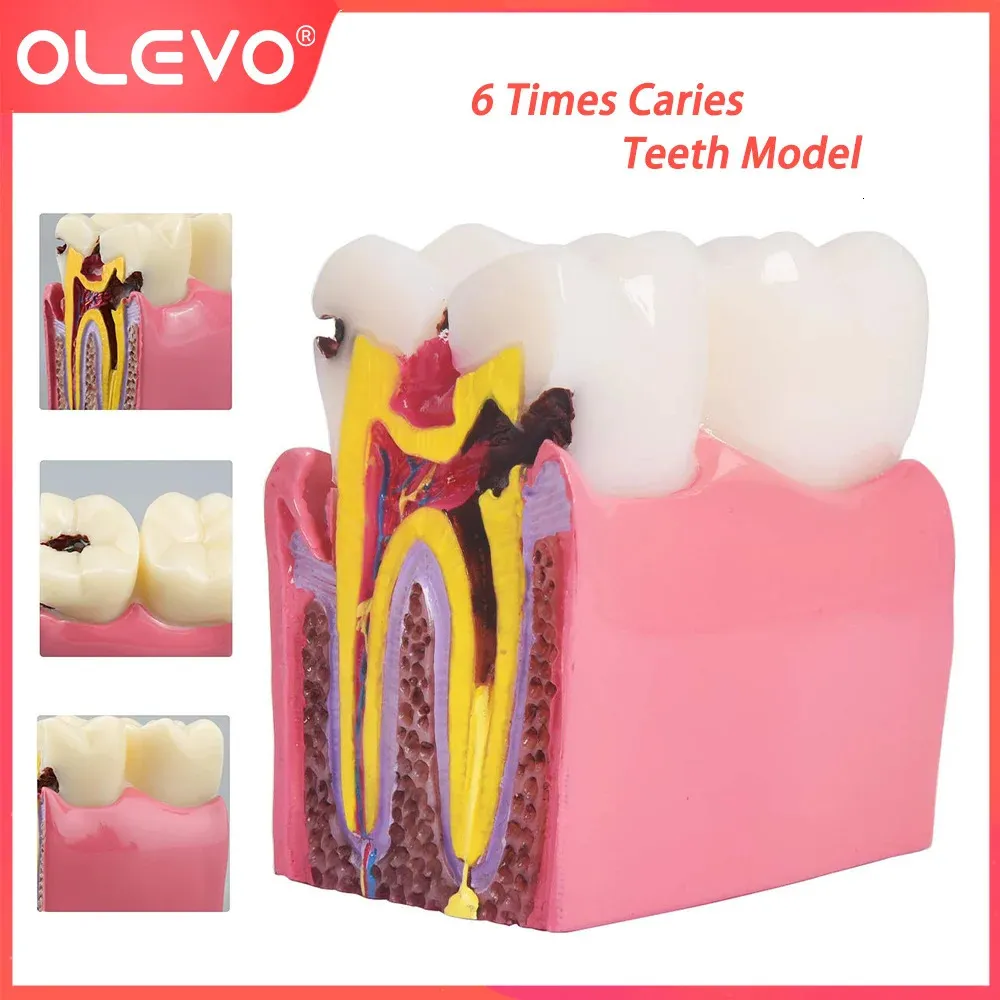 Anatomical Teeth Models OLEVO 6 Era Dental Teaching Tooth Model For ...