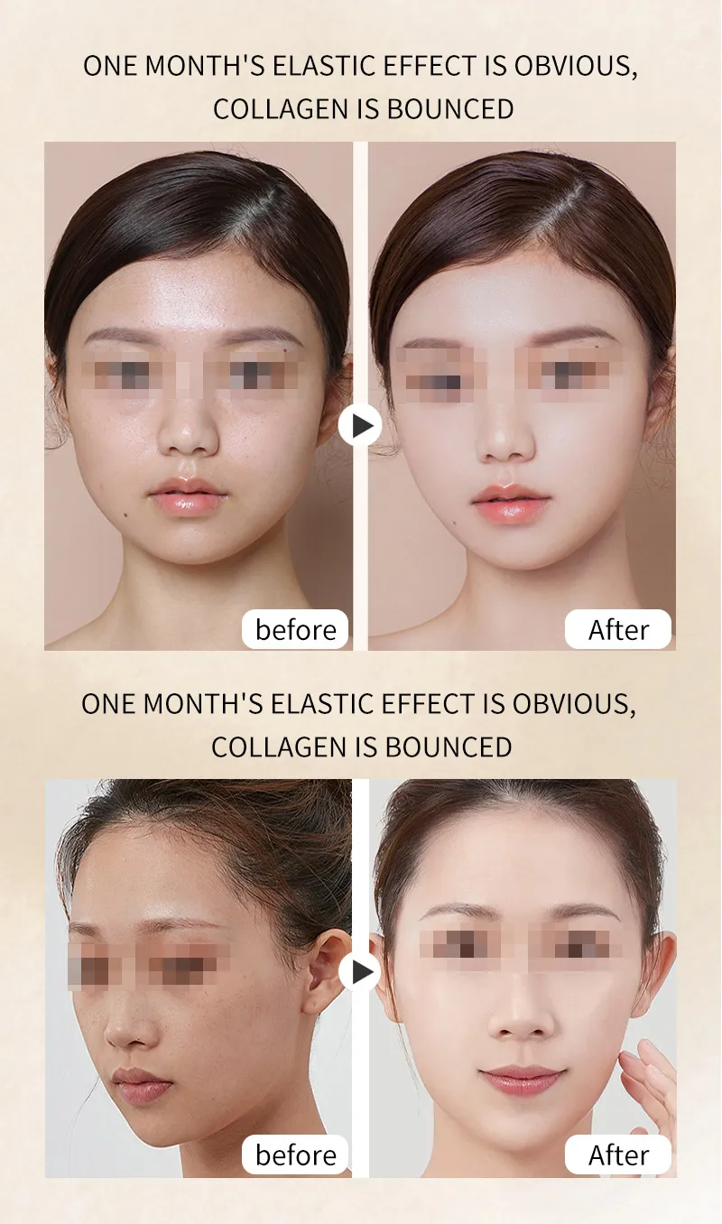 Portable V Max 7D Hifu Ultrasonic Face Lifting Machine for Skin ...