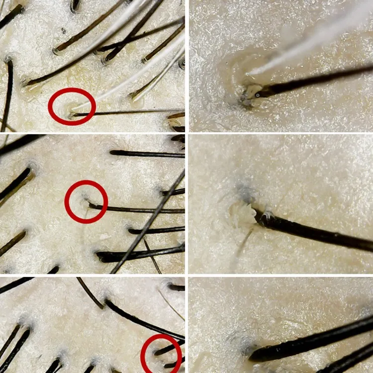 13 In 1 Hydra Aqua Facial Radio Frequency Face Lifting Diamond ...