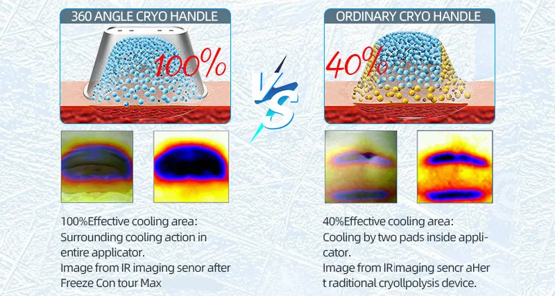 360 Angle Cryolipolysis Fat Freeze RF Skin Tighten Cavitation Lipolaser ...