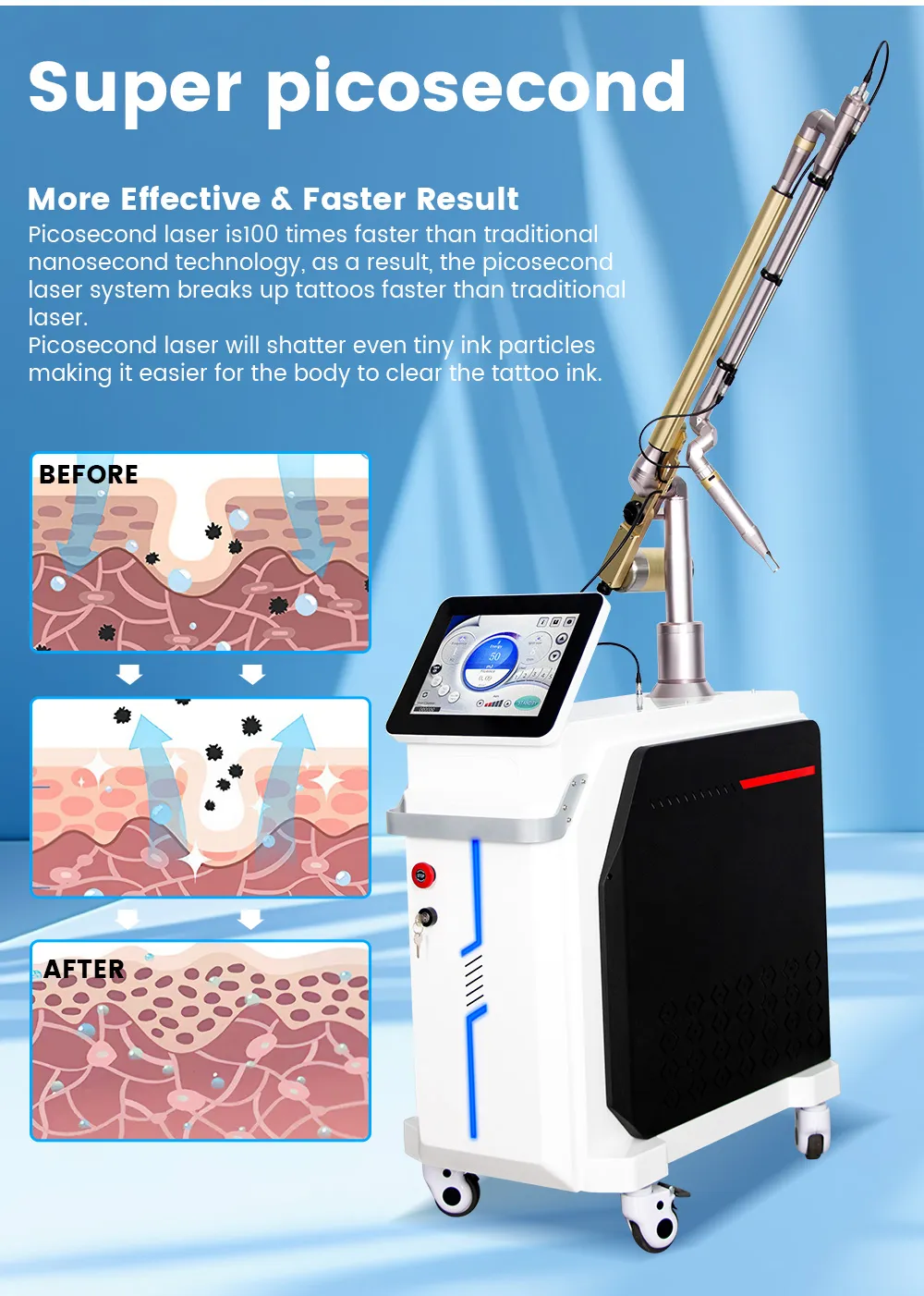 Professional Picosecond Laser Machine for Beauty Clinics: High ...