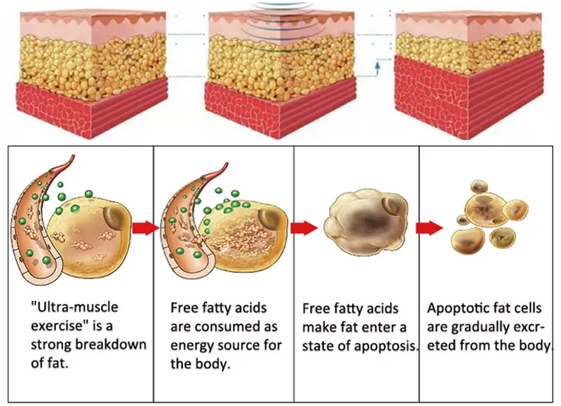 4 Handles HIEMT Fat Burn Muscle Increase Beauty Machine with 15.6-Inch ...