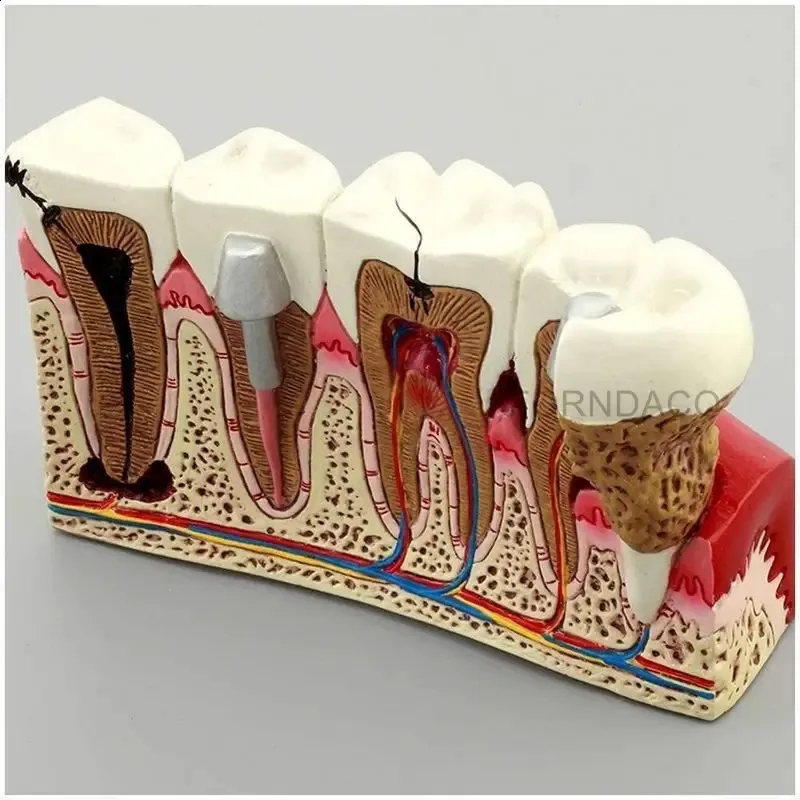 Dental Anatomy Oral Model 3 For Teaching And Communication ...