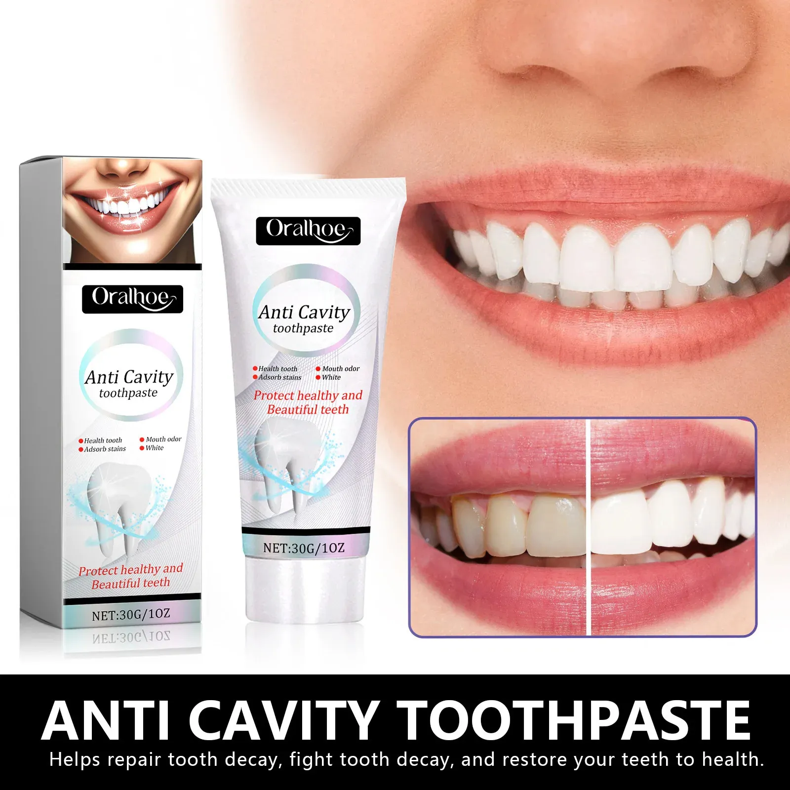 Oralhoe 30g Anti Cavity Natural Whitening Toothpaste For Teeth Repair ...
