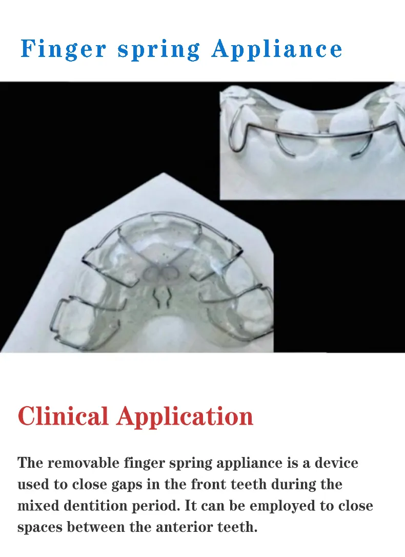Orthodontic Traction Aligners Early Treatment Plastic Spring Arch ...