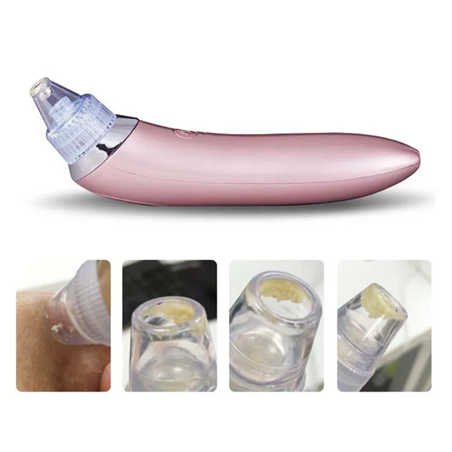Effective Strategies to Gently Clean Clogged Pores and Prevent Future ...