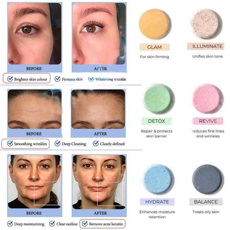 Poss De Soins De La Peau 6 En 1: CO2 Capsules Infusées À L'oxygène Pour ...