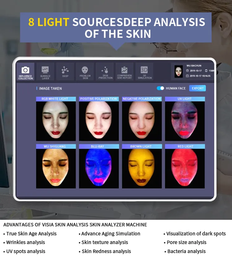 Portable 3D Digital Skin Analysis Machine With 36 Million Piex ...