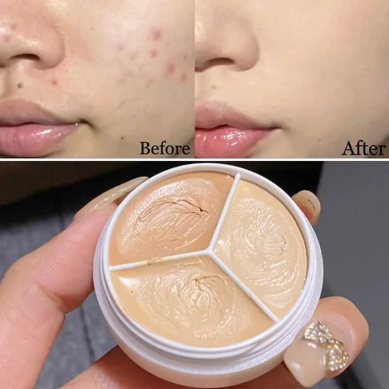 3-Color Concealer Palette - Creamy Coverage for Acne, Dark Circles ...