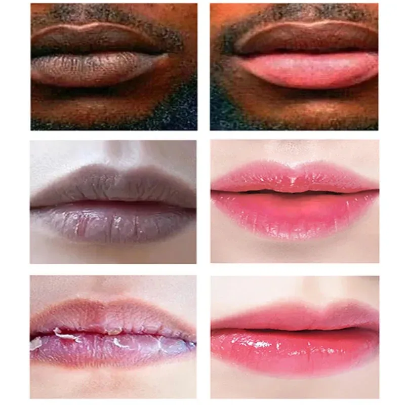 Dark kiko lip glosses Treatment - Removes Dark Smoke, Moisturizes Fine ...