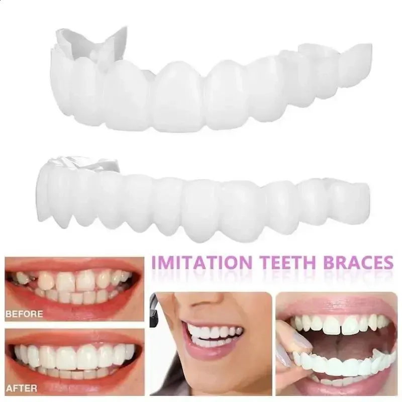 Adjustable Snapon Setting Teeth Dentures For Adults Portable Braces And ...