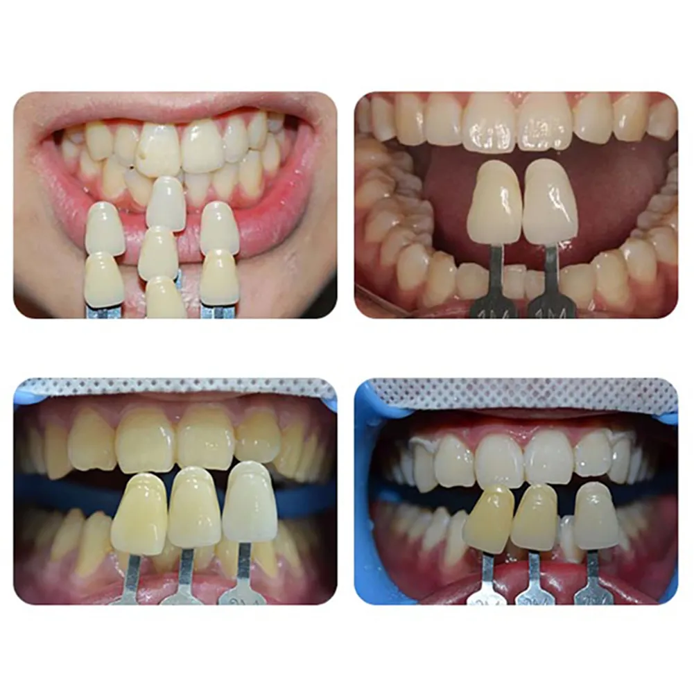 Dental Shade Guide - Vita Classical Teeth Whitening Shade Matching, 3D ...