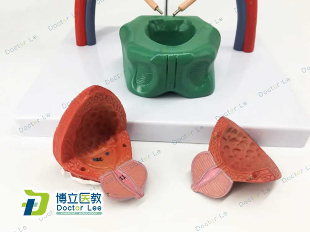 Anatomical Teeth Models: Human Urinary System Model Kidney, Ureter ...