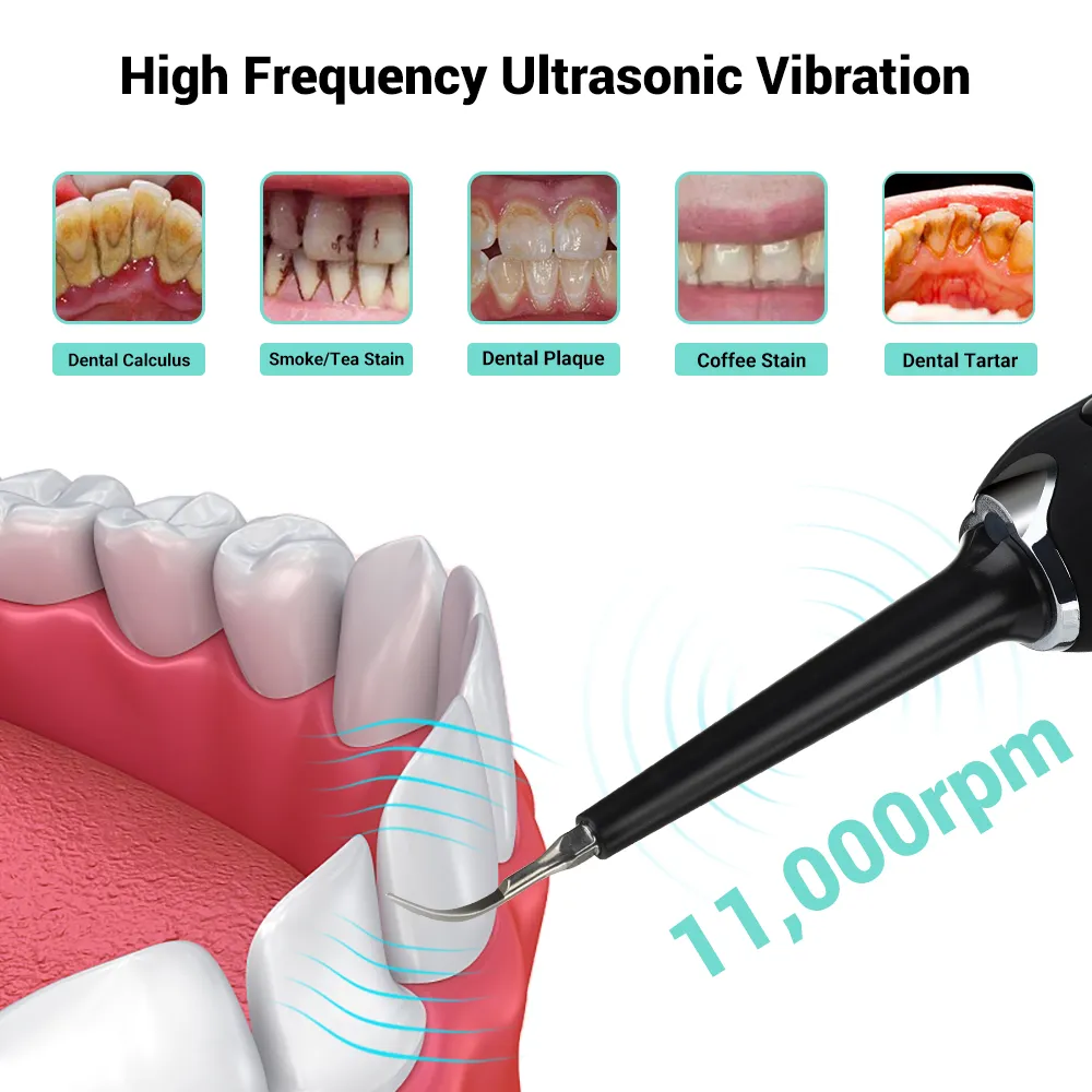 Electric Dental Scaler Sonic Tartar Plaque Calculus... From Ddmydec ...