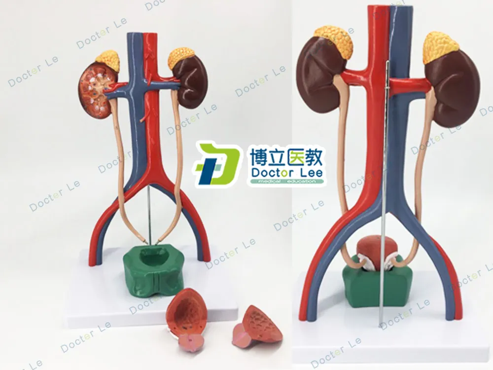 Anatomical Teeth Models: Human Urinary System Model Kidney, Ureter ...