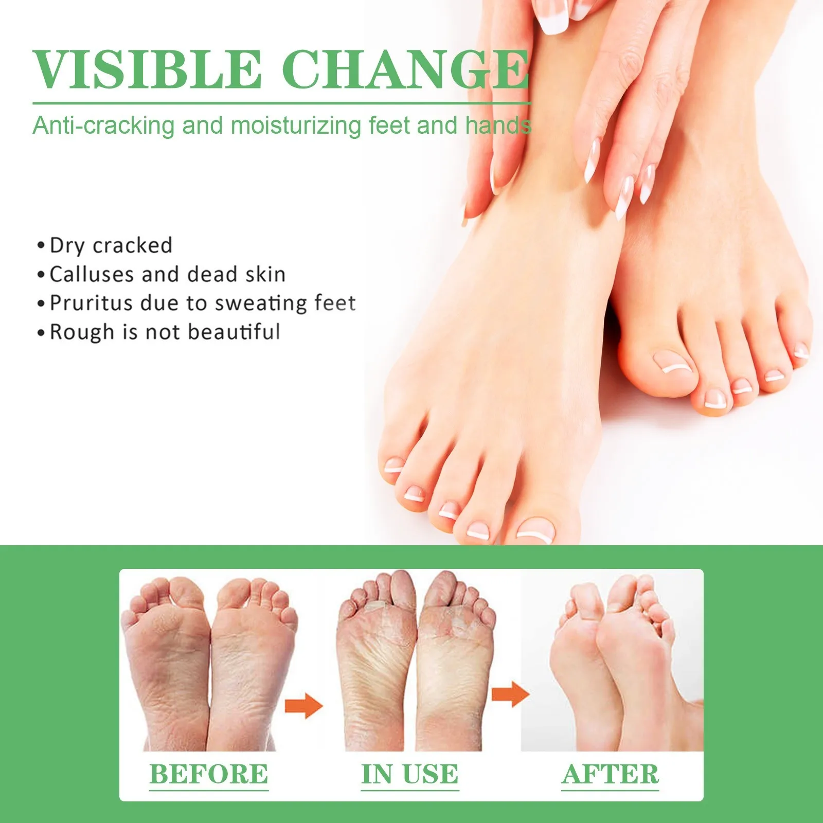 Moisturizing nail trimmer for dogs for Babies - Dry and Cracked ...