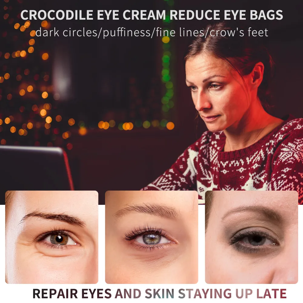 Anti Aging Crocodile Eye Cream Eye Repair Reduces Dark Circles Under ...