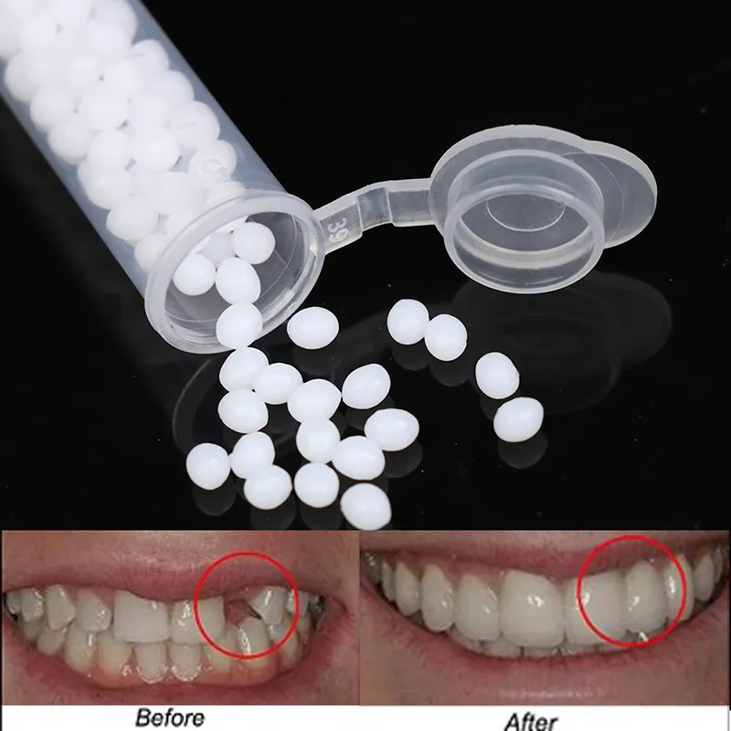 Temporary Repair Kit And Gaps Set False Solid Glue For Teeth Whitening And Denture Adhesive Gum ...