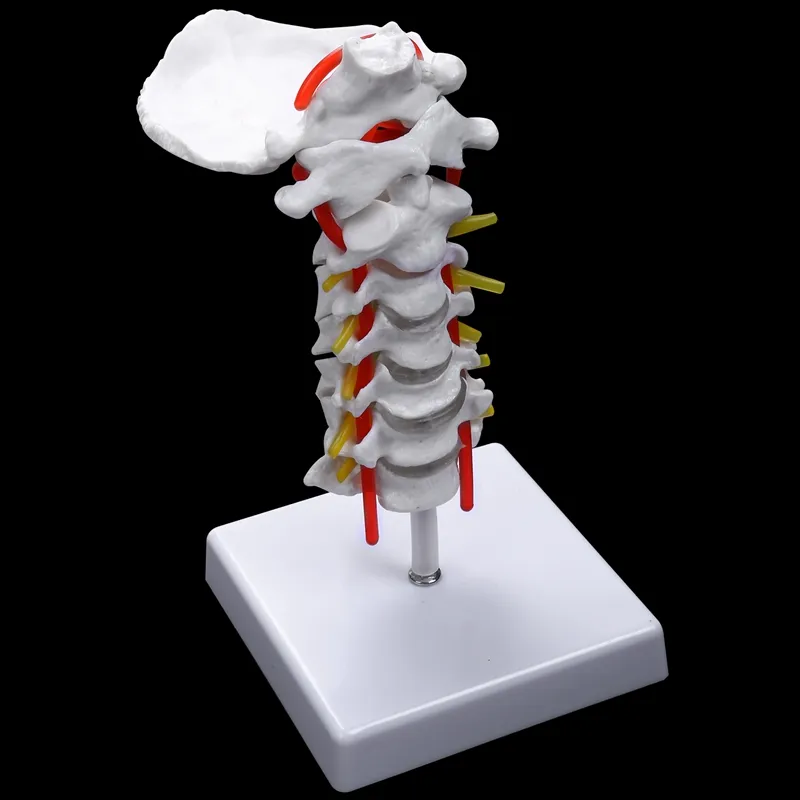 Cervical Vertebra Spine Anatomical Model Arteria And Spinal Nerves For ...