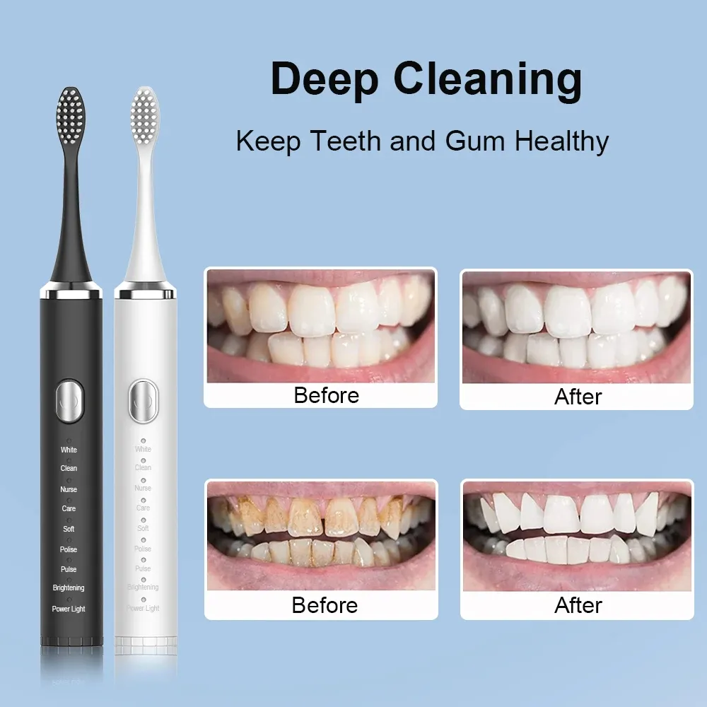 Sonic Tooth Cleaner Rechargeable Electric Toothbrush With Soft Bristles ...